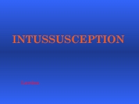Intussusception definition